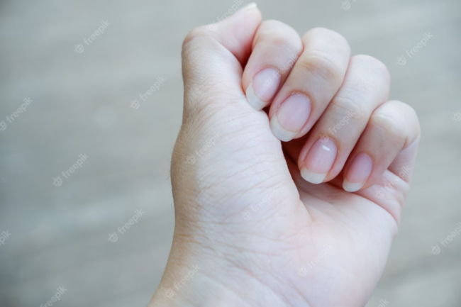 Taches Blanches Sur Les Ongles Quest Ce Que Cest France Manucure